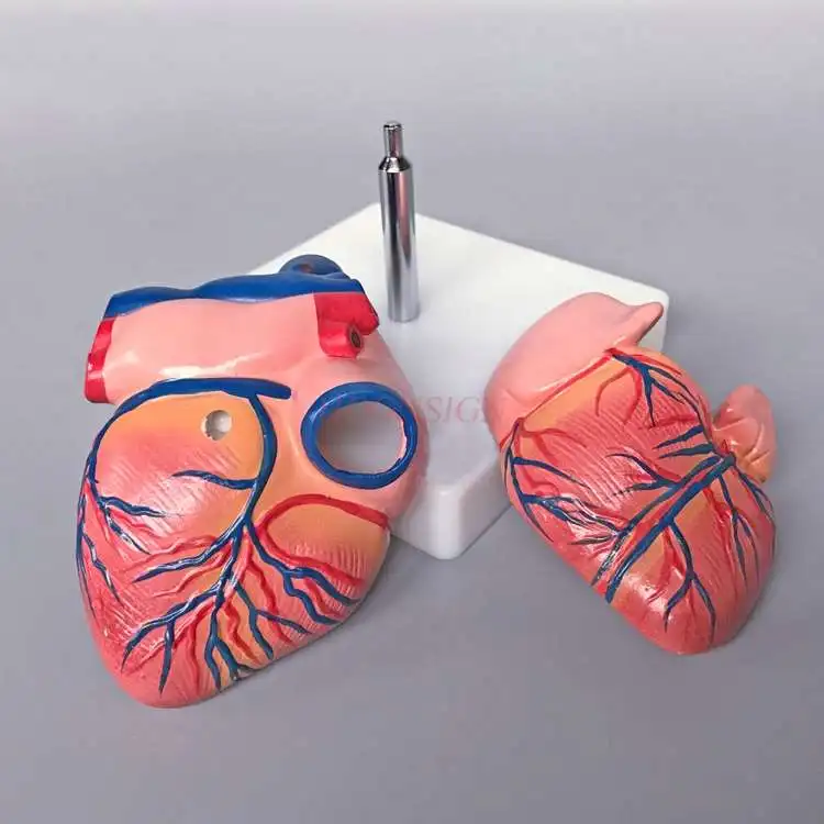 Large Heart Model Heart Anatomy Model Enlarged Cardiovascular ...