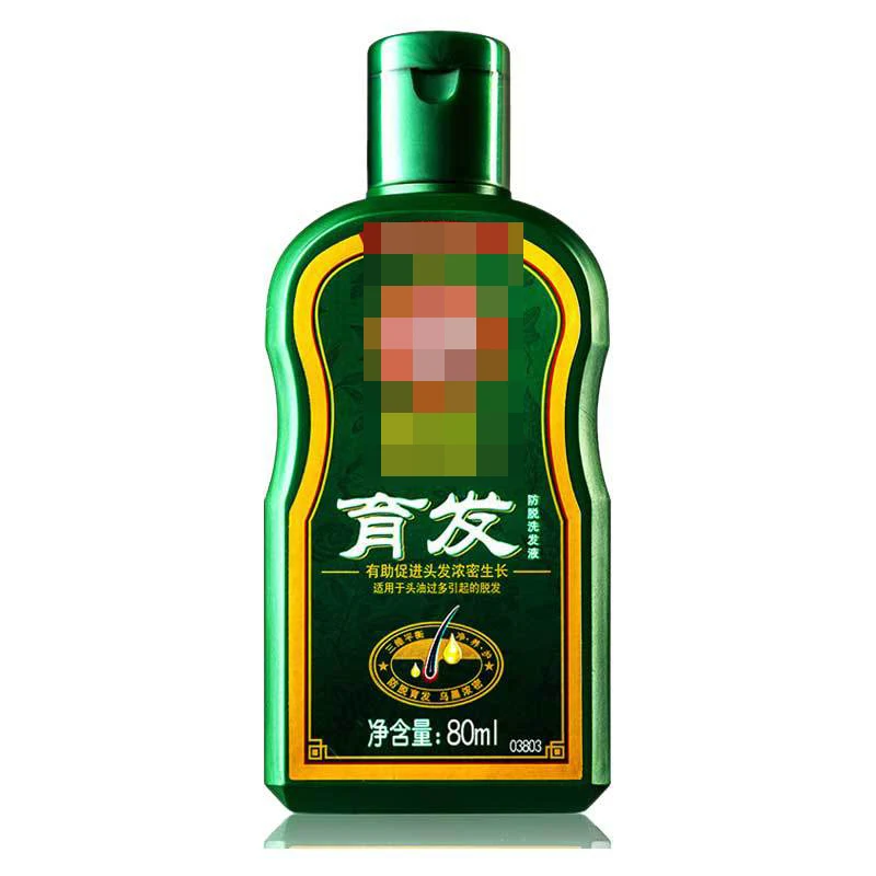 Chinese Herbal Medicine Hair Growth Dense Ginger Shampoo Anti-hair loss ...