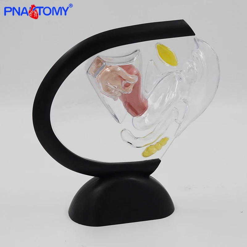 Female Uterus Model Transparent Female Genital Organ Ovary Anatomical ...