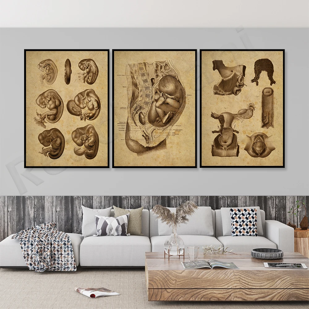 vintage Posters Fetus in Womb Antique Illustration Embryo Pregnancy ...