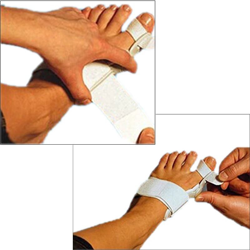 Universal Cuff Splint