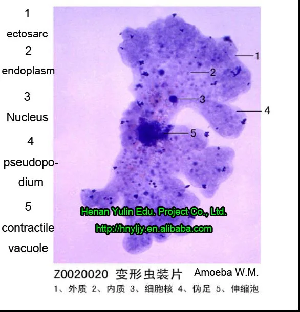 Amoeba Slide Labeled