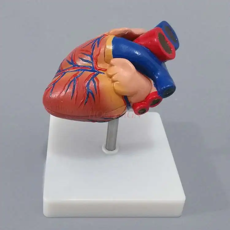 Large Heart Model Heart Anatomy Model Enlarged Cardiovascular ...