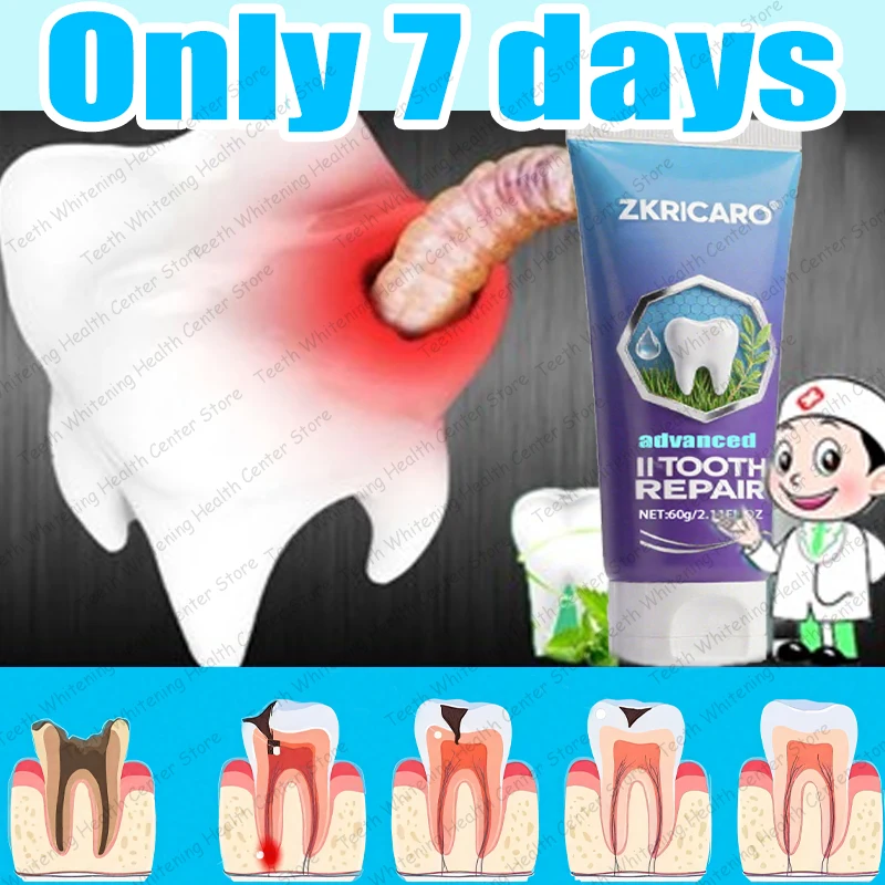 Toothpaste for denture cleaning | AliExpress