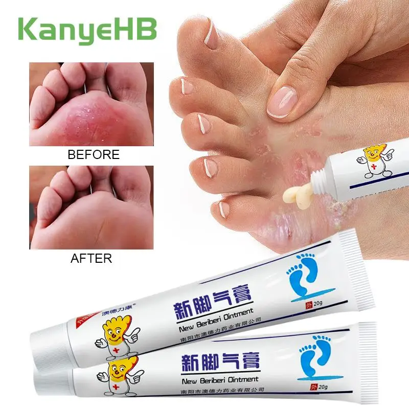 Крем от грибка ног kanyeHB 2 шт. | AliExpress