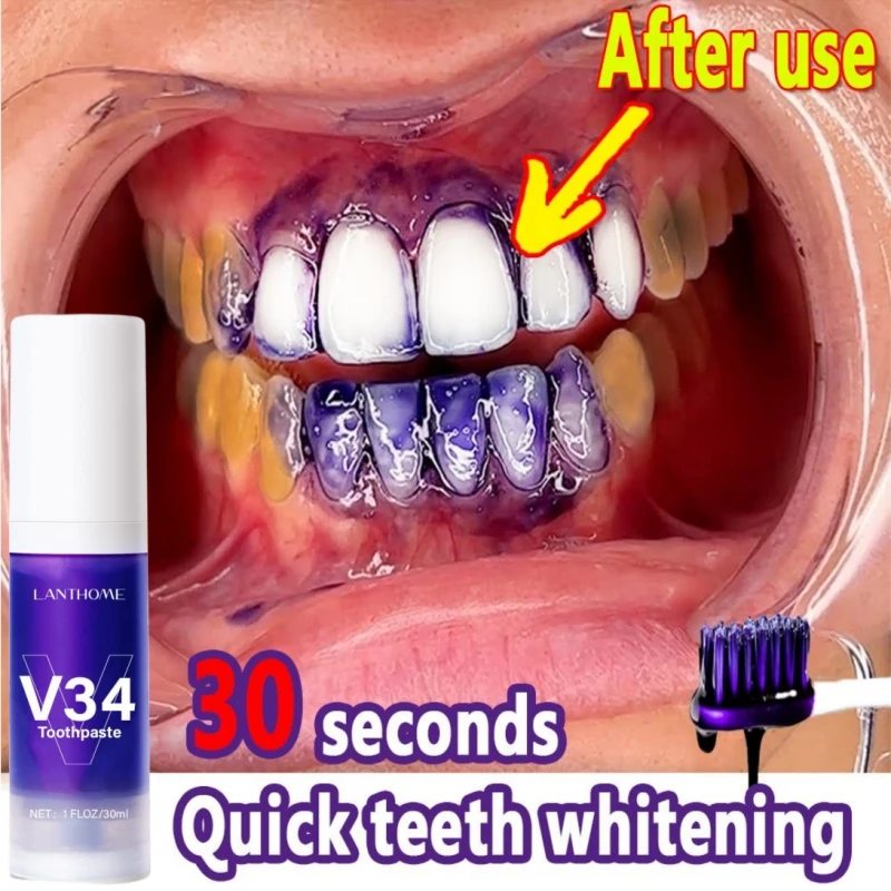 PWYUMAN V34 Pro Фиолетовый корректор для отбеливания зубов | AliExpress