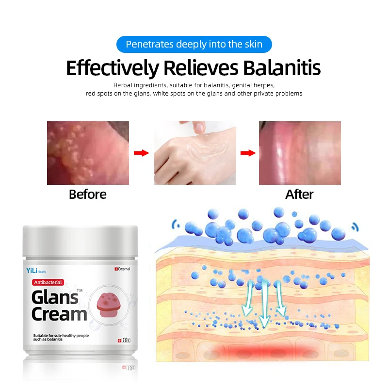 Balanitis Vs Herpes