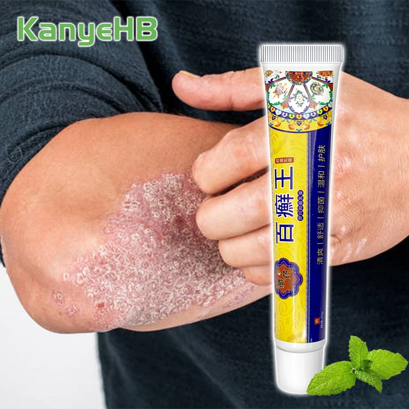 Мятный крем от псориаза kanyeHB | AliExpress