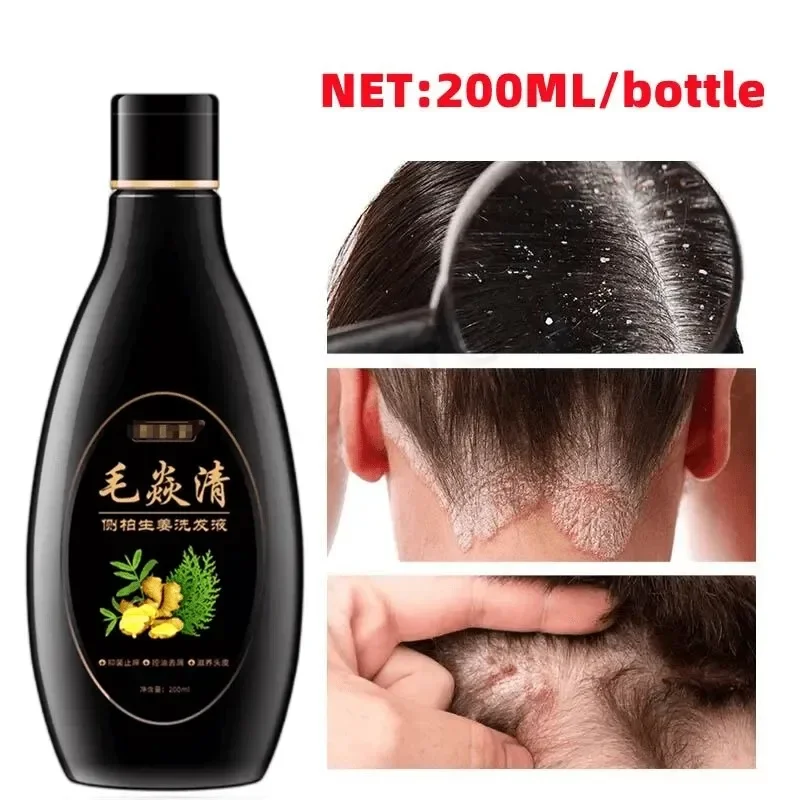 Шампунь для удаления волосяных фолликулов и клещей кожи головы ...