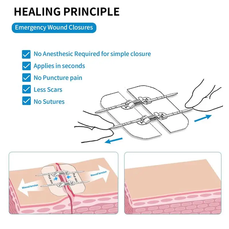 URIT 2/4/6 Pcs Zipper Band-aid Painless Wound Closure Device Suture ...
