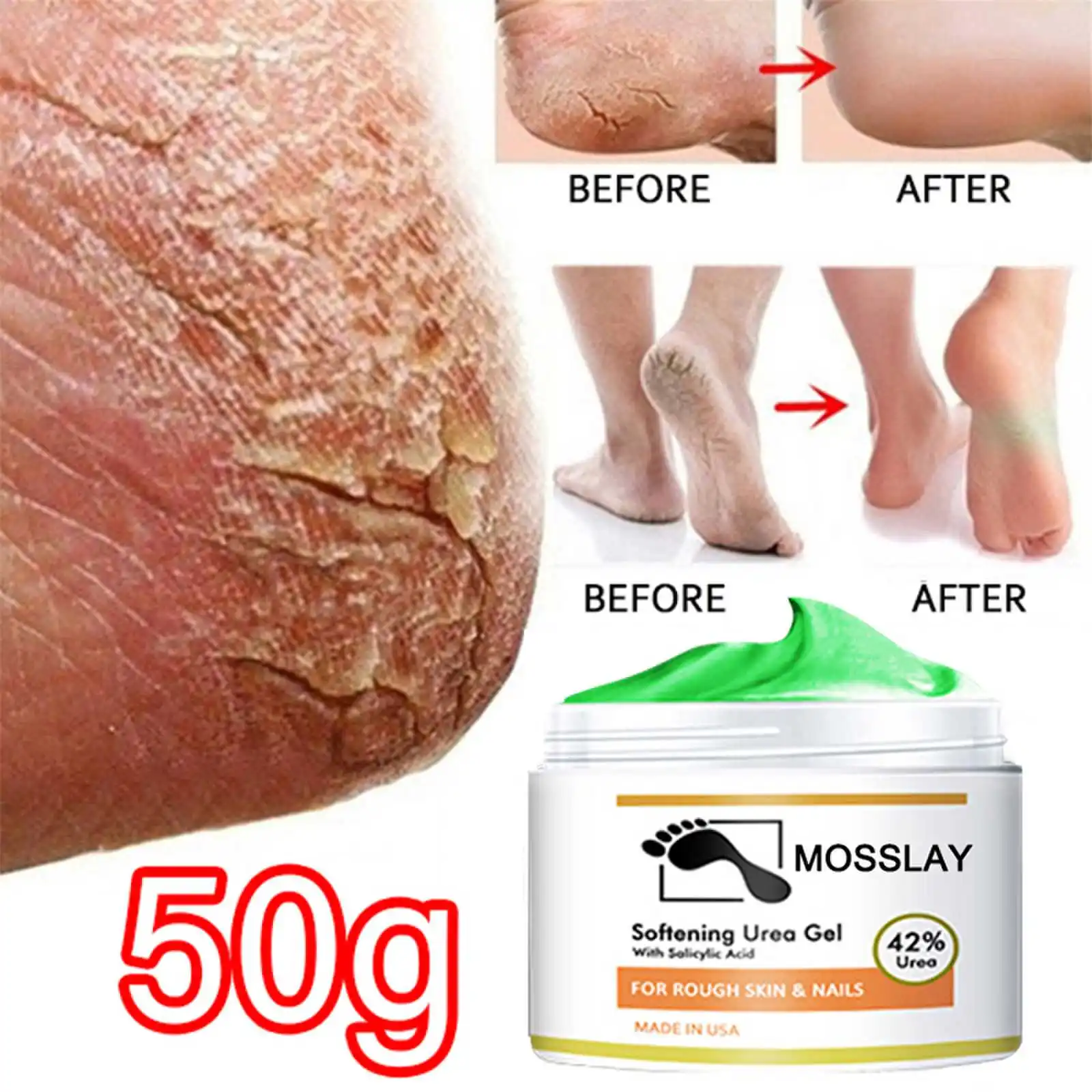 Cracked Foot Cream | Foot-cream.org