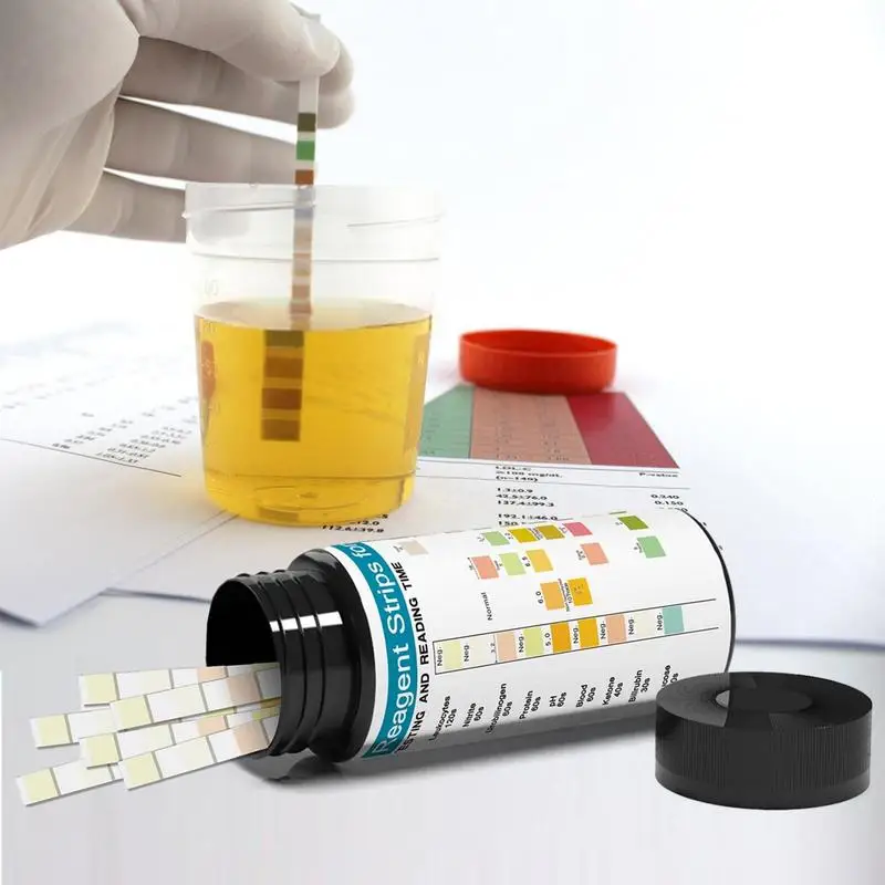 100 Strips URS-9 Urinalysis Reagent Strips Urine Test Strip Leukocytes ...
