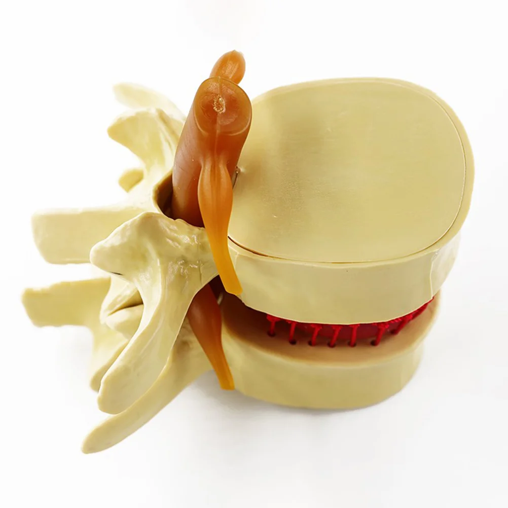 Intervertebral Disc Model Lumbar Spine Demonstrating Vertebrae ...